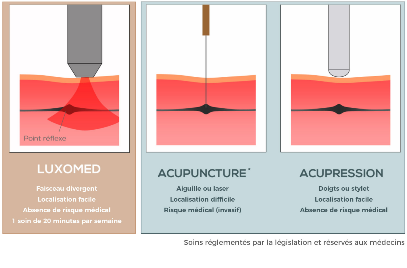 Luxopuncture – Neurolux – Delphine Levy